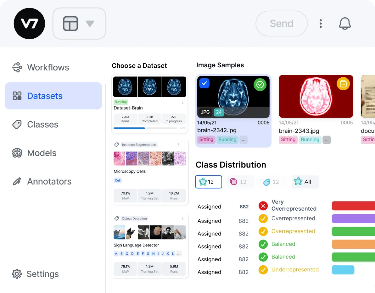 V7 | The AI Data Engine for Computer Vision & Generative AI